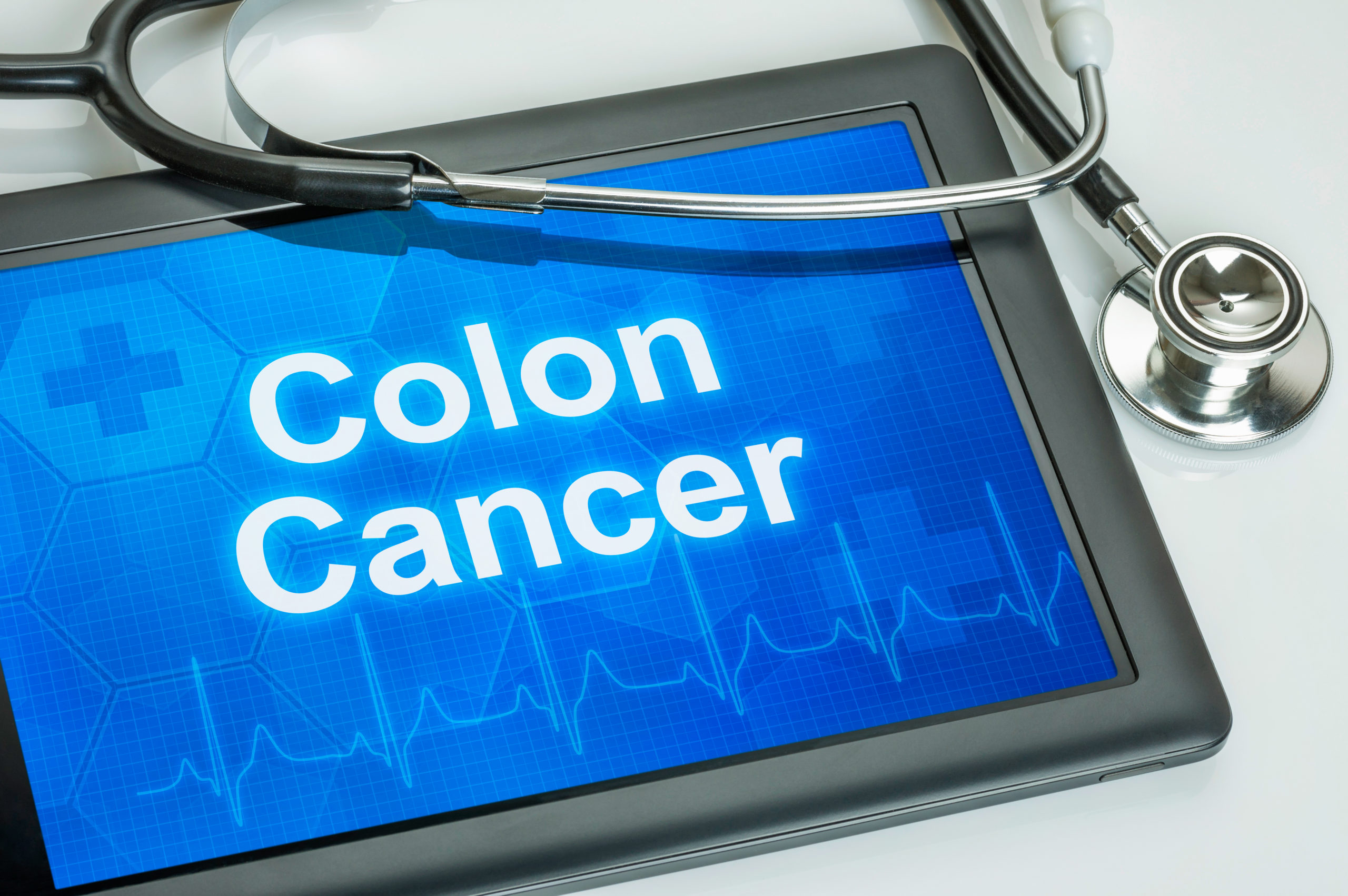 At what age should I get screened for colon cancer? - Testing.com